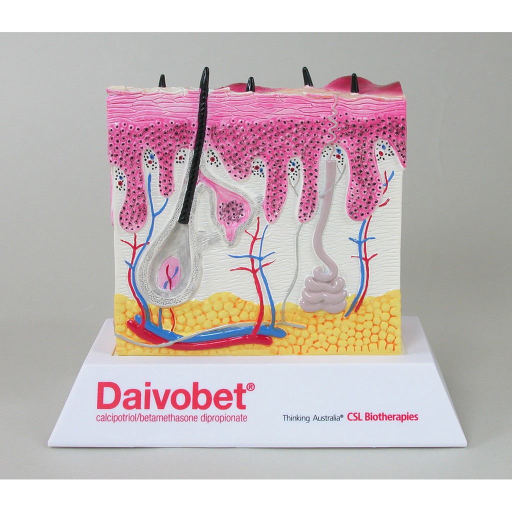 乾癬 牛皮癬 人體皮膚結構解剖教學模型 Psoriasis Skin Model | 蝦皮購物