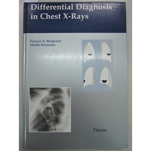[阿維的書店14] Differential Diagnosis in Chest X-rays 胸腔X光鑑別診斷 | 蝦皮購物