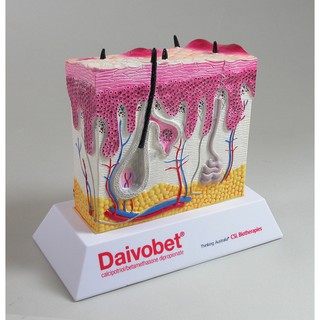 乾癬 牛皮癬 人體皮膚結構解剖教學模型 Psoriasis Skin Model | 蝦皮購物