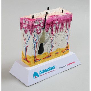乾癬 牛皮癬 人體皮膚結構解剖教學模型 Psoriasis Skin Model | 蝦皮購物