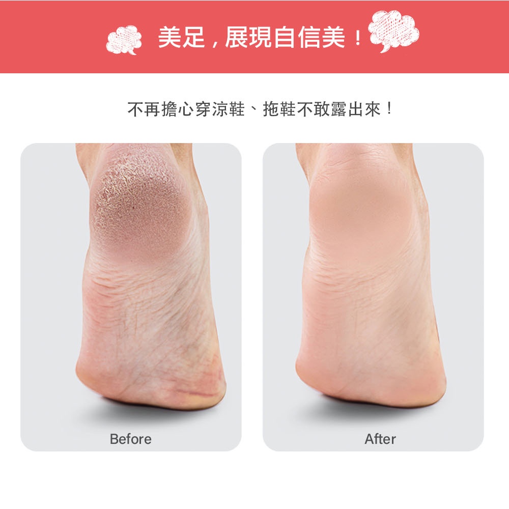 Miro.lu 全方位角質護理板四合一 去腳皮 磨腳器 搓腳板 清潔刷 | 蝦皮購物