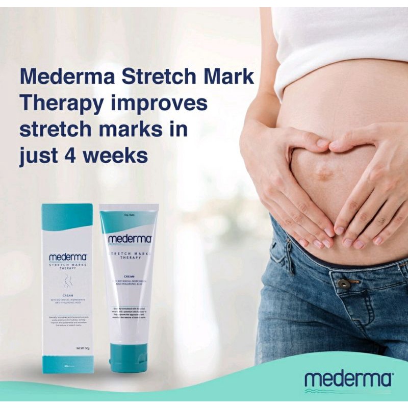 New mederma Stretch Marks Therapy Cream50G | 蝦皮購物