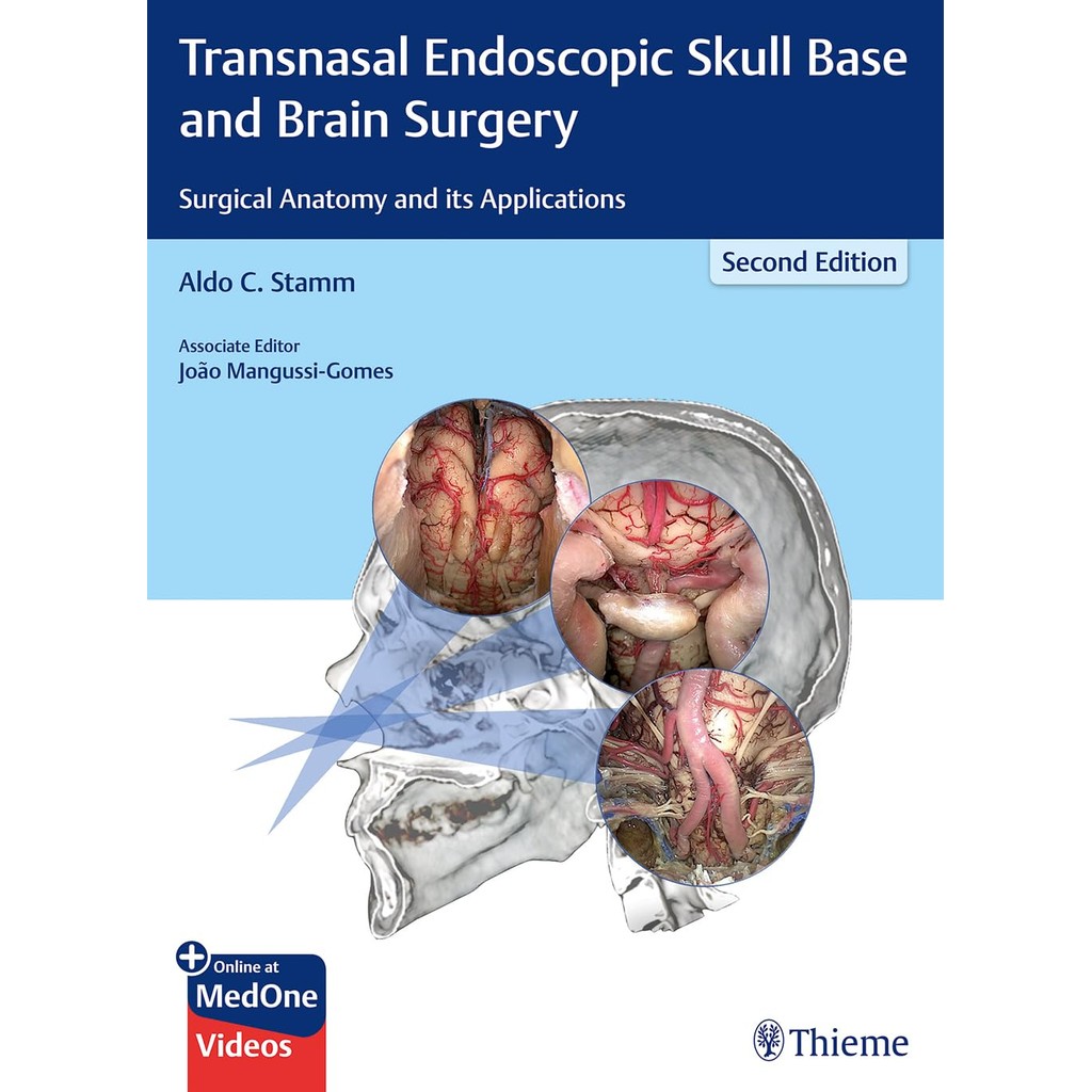 Transnasal Endoscopic Skull Base and Brain Surgery ― Surgical Anatomy ...