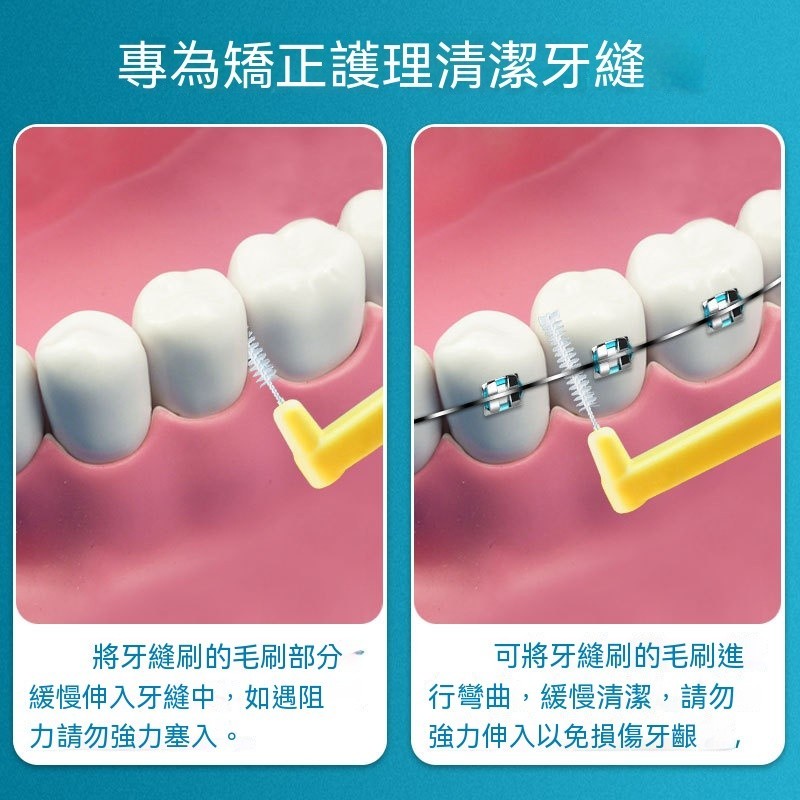 牙間刷 軟式牙間刷 牙縫刷 齒間刷 齒縫刷 便攜式軟式牙間刷 軟式牙縫刷 軟式牙尖刷 齒縫清潔刷 牙齒清潔刷 | 蝦皮購物