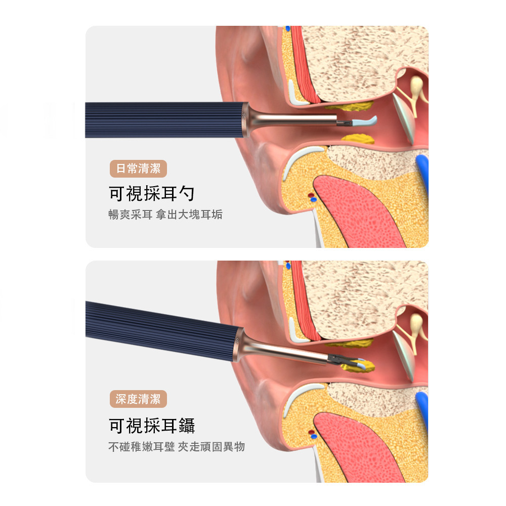 Bebird 三合一全能可視採耳棒 Note3 Pro 台灣版 夾取式 採耳神器 智能採耳 可視化 掏耳棒 採耳棒 | 蝦皮購物