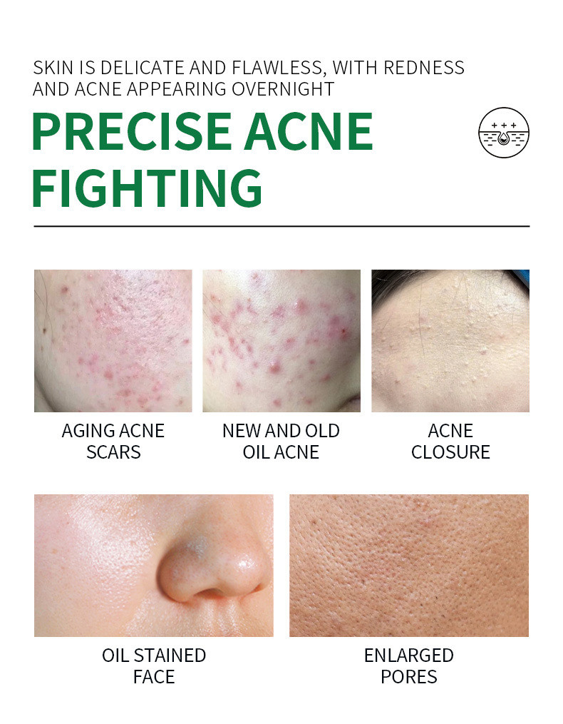 Go👍 Acne scar repair lotion hydrating, moisturizing and fi | 蝦皮購物