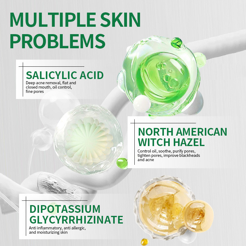 Go👍 Acne scar repair lotion hydrating, moisturizing and fi | 蝦皮購物