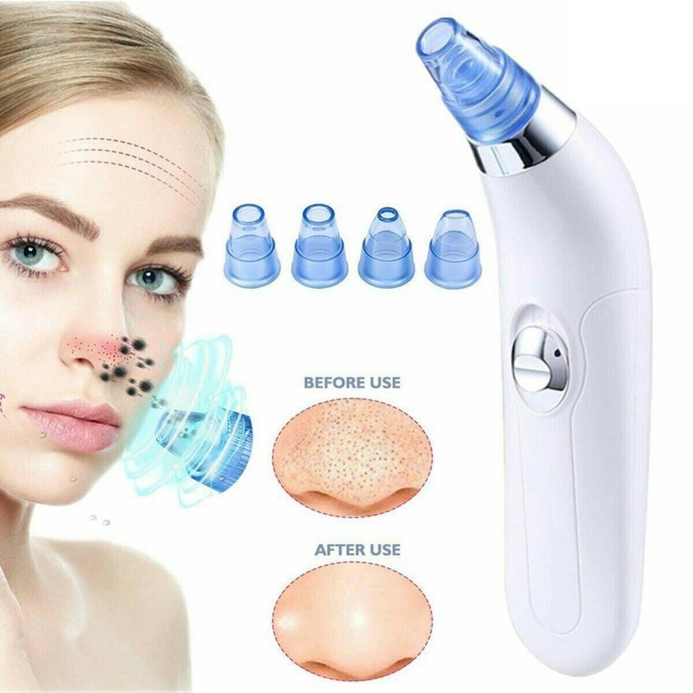 Acne Pimple Clean-Skin-Tool Removal-Face Blackhead-Remover D | 蝦皮購物