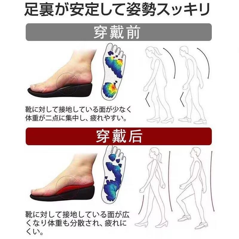 🔥臺灣出貨24h🔥日本扁平足墊足弓墊糾正平底足xo型腿鞋墊支撐足外翻足底神器hhfoof | 蝦皮購物