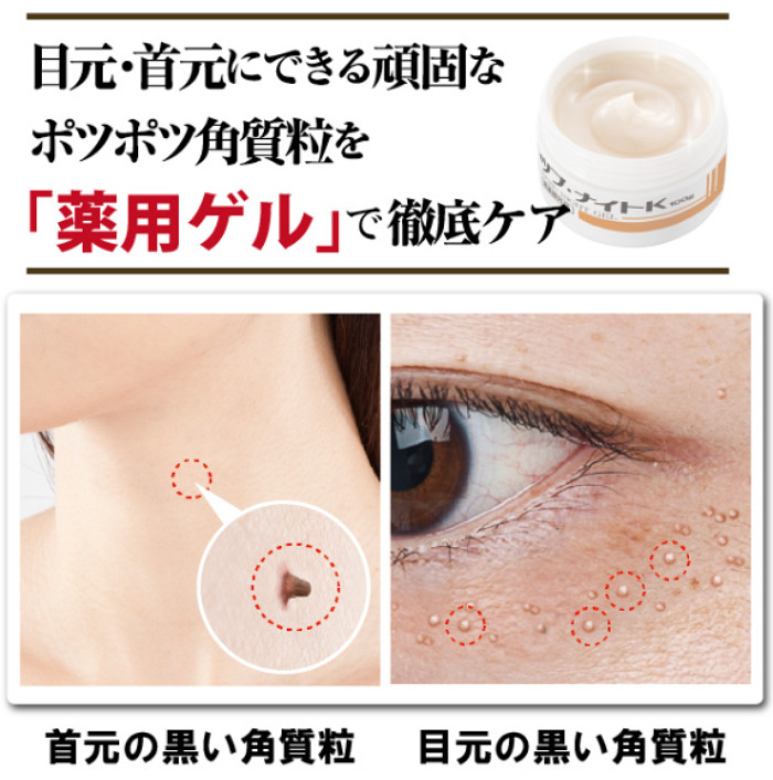 [台灣現貨+全台最低價]Tsubu Night Pack 眼霜 去肉芽 脂肪粒 角質粒眼膜/美容霜/夜間修護貼 | 蝦皮購物