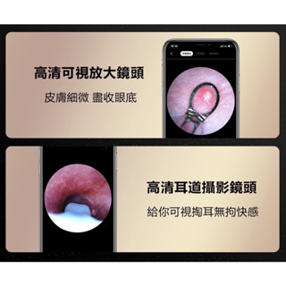 [Glolux]多功能可視採耳棒 掏耳棒 掏耳內視鏡 攝影掏耳棒，結合擠痘功能 | 蝦皮購物