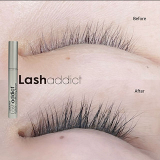 現貨｜100%正貨 代購日本最夯 Lashaddict 睫毛滋養精華 5ml 纖長 濃密 | 蝦皮購物