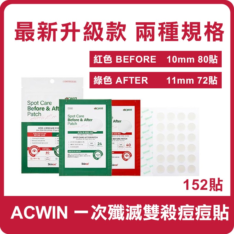 韓國 Acwin 早晚替換大容量痘痘貼 一次殲滅雙殺痘痘貼 152貼 最新升級款 痘痘貼 | 蝦皮購物