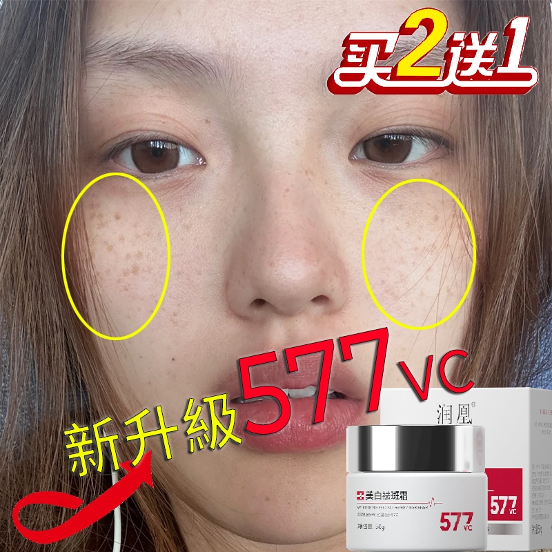 【新升級577】淡斑霜 美膚霜 美白面霜 377淡斑霜 黑點霜臉部黑塊 雀斑淡化黑色素淡斑提亮膚色精華霜美白煥白提亮美白 | 蝦皮購物