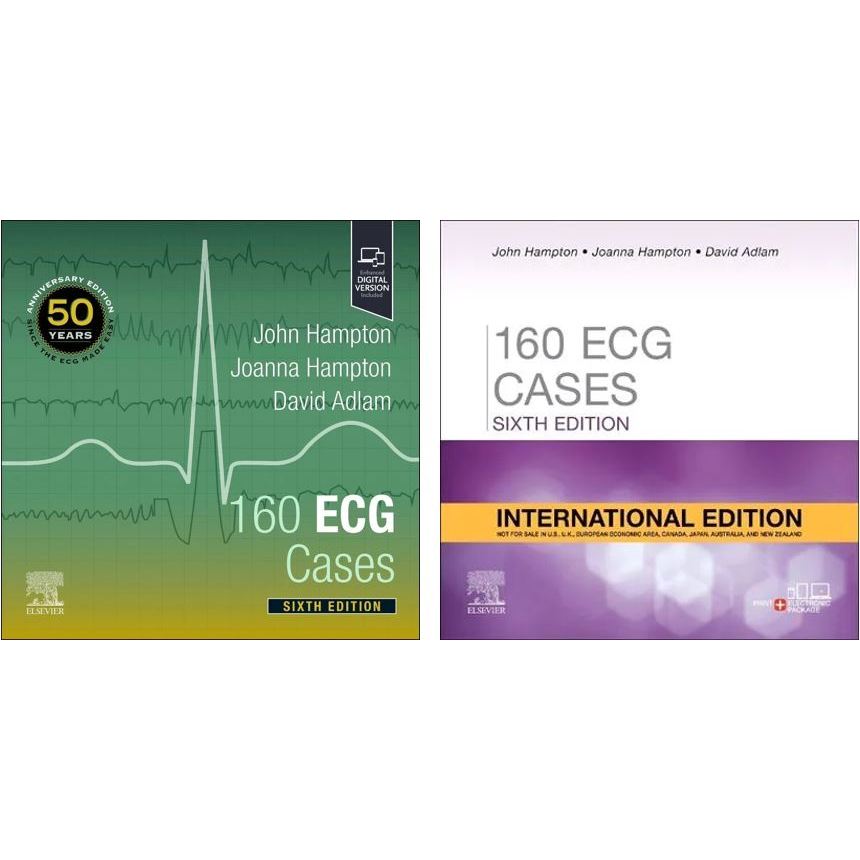 【華通書坊】160 ECG Cases 2025 Hampton / Elsevier 9780323937658/9780323937825 ...