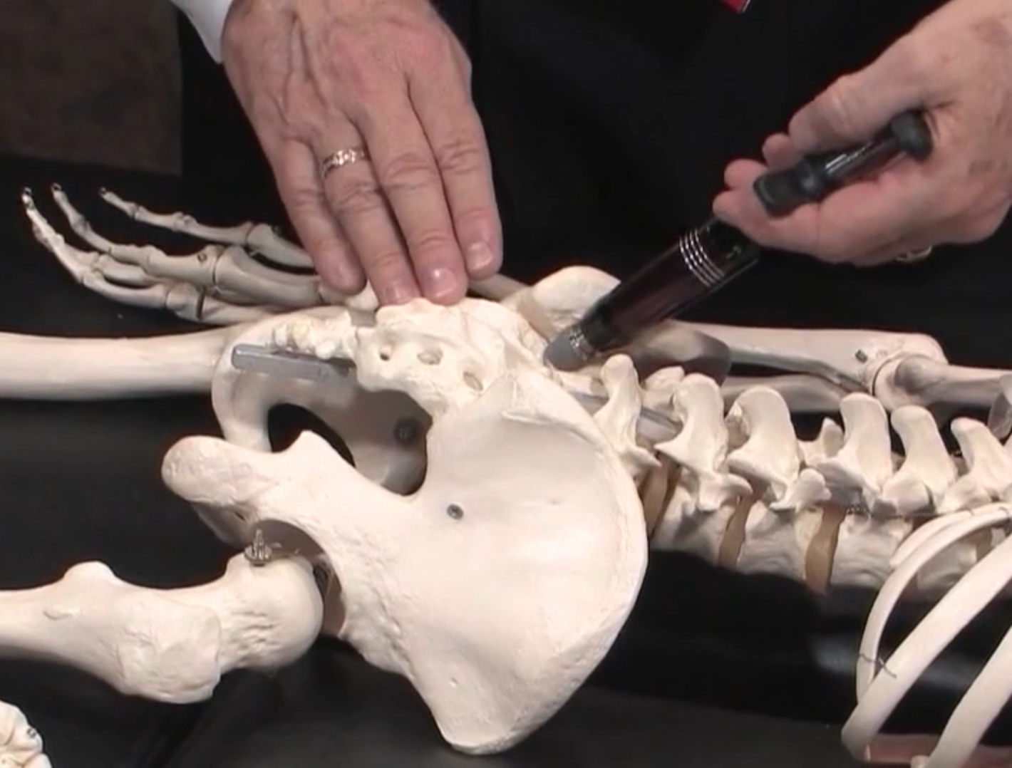 【鈦自在養健醫材】現貨 5顆裝 美國Activator IV 活化器AMCT 槍頭 耗材 | 蝦皮購物