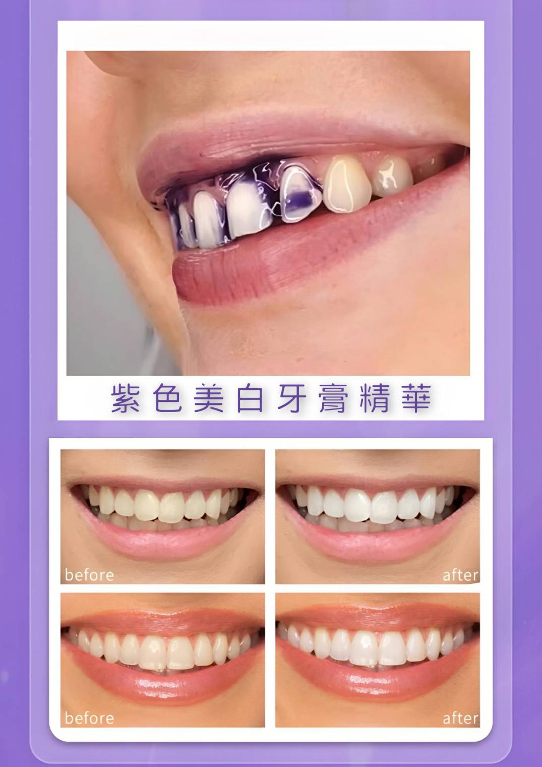 【現貨】澳洲HVIQAN 小紫瓶 V34紫色牙膏 美白牙齒 口腔清潔 慕斯牙膏 牙膏精華液 紫色牙膏 口腔照護 光學色修 | 蝦皮購物