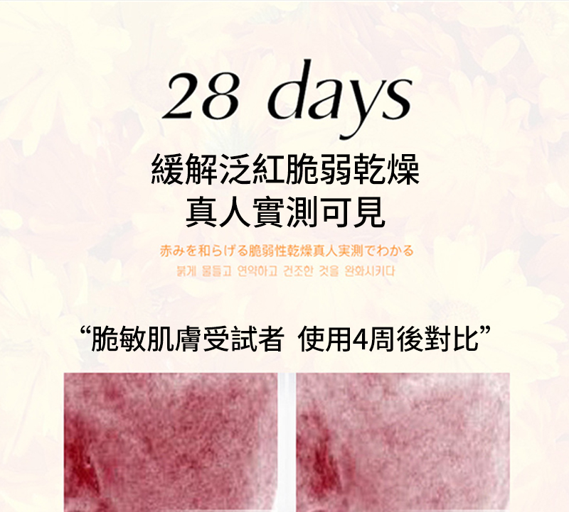 Suke.co 台灣現貨 OPOSI 金盞花 精萃 爽膚水 控油 植物 精華水 保濕 化妝水 契爾氏平替款 鎮店寶 | 蝦皮購物