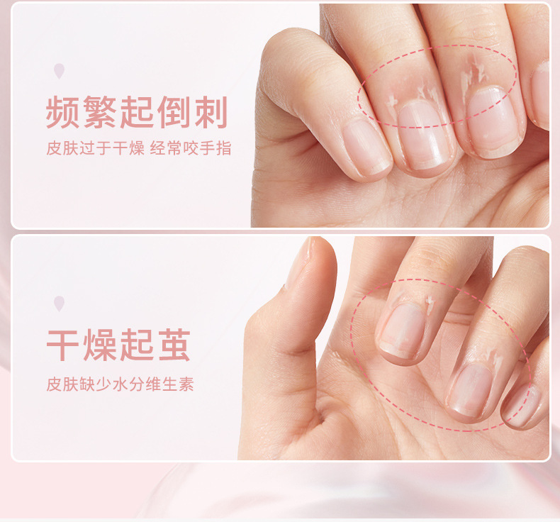 徐太太🌸【台灣現貨】健美創研護甲油『3件99元』：精選滋養成分，專為指緣與甲面設計，深層滋潤乾燥受損的指甲 蝦皮購物