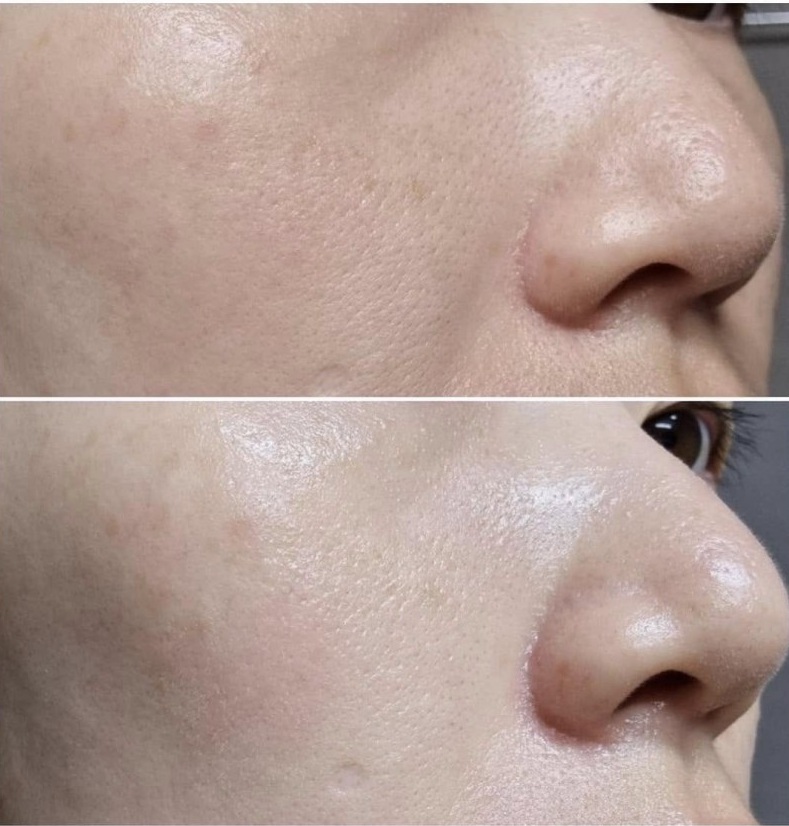 現貨供應【韓國【DEMAR 3】毛孔無痕 x 驚嘆美肌 x 精萃安瓶170ml/效期: 2027下半年/數量有限/售完 | 蝦皮購物