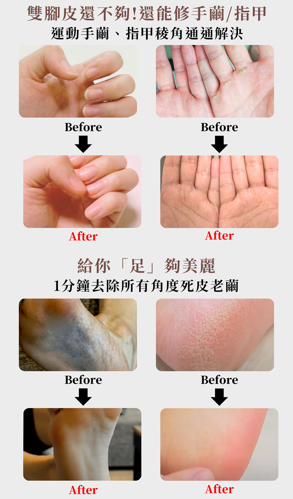 【Fullidea】FootShine 集塵美足機 嫩足機 手持修足 電動磨腳皮機 腳皮 角質 去死皮 去老繭 足部保養 | 蝦皮購物